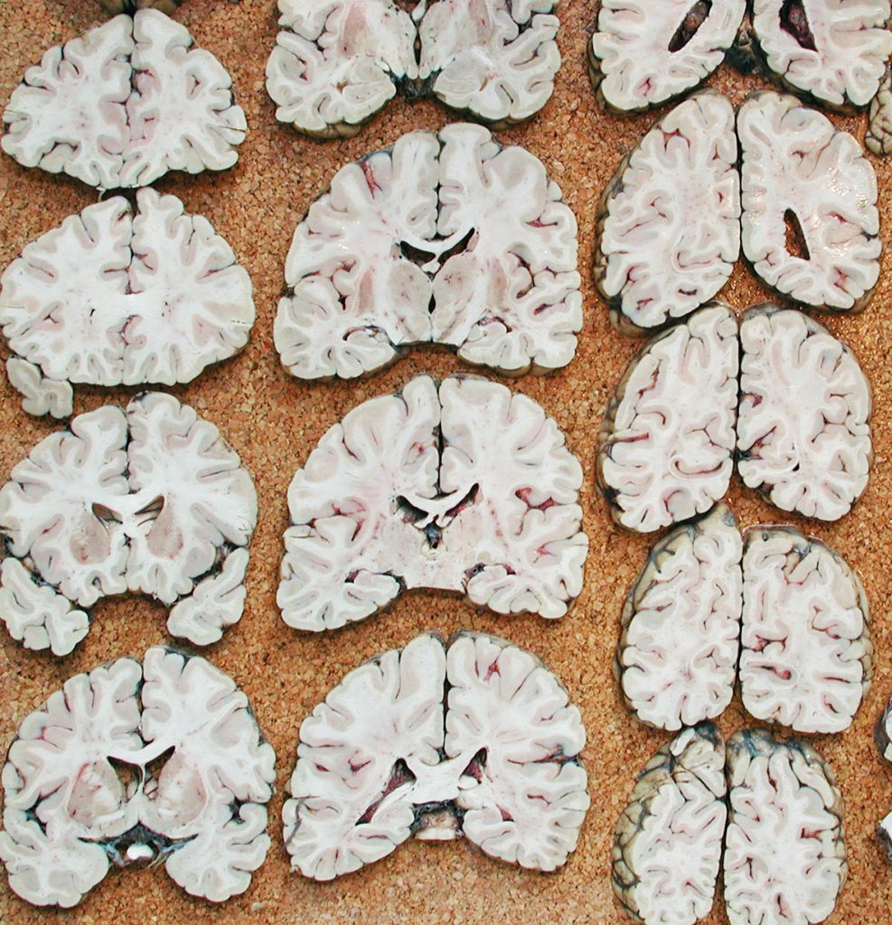 BRAIN UK Ref: 14/014 – Positive control tissue in direct and indirect ...